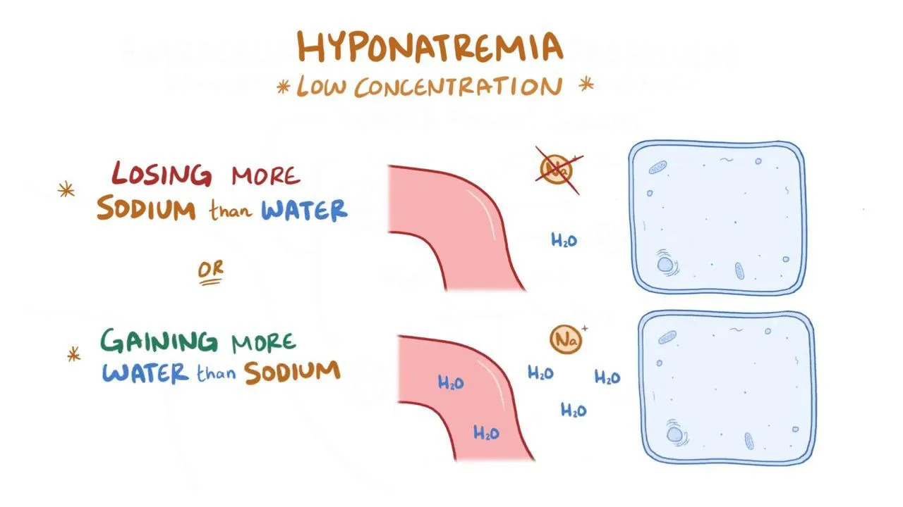 How bad is Deficiency and Toxicity of Sodium?